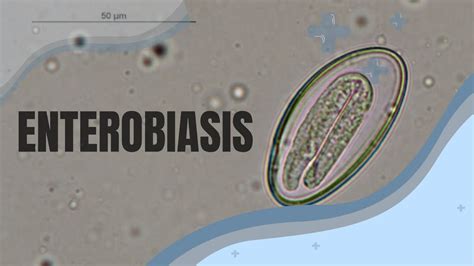 Enterobiasis Youtube