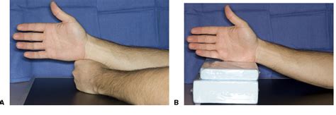 X Ray Wrist Lateral View