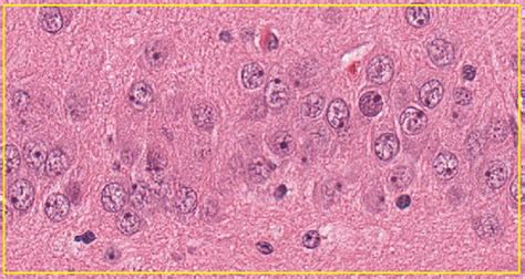 Difficulty With He Cell Detection On Qupath Usage And Issues Image Sc