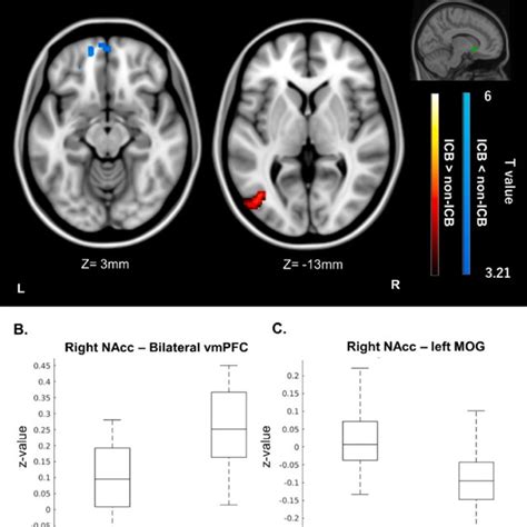 Seed Based Correlation Analysis Comparing The Functional Connectivity