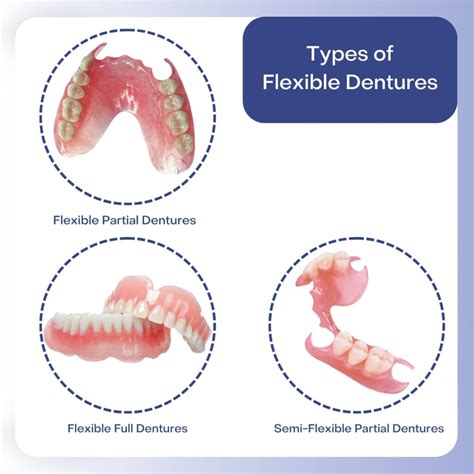 Flexible Dentures East Bronx Ny Bronx Dental Spa