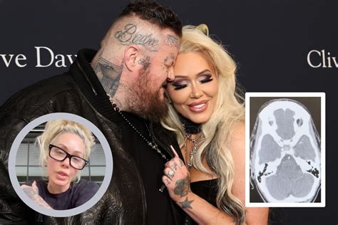 Jelly Rolls Wife Bunnie Xo Shares A Scary Health Update Cream Music