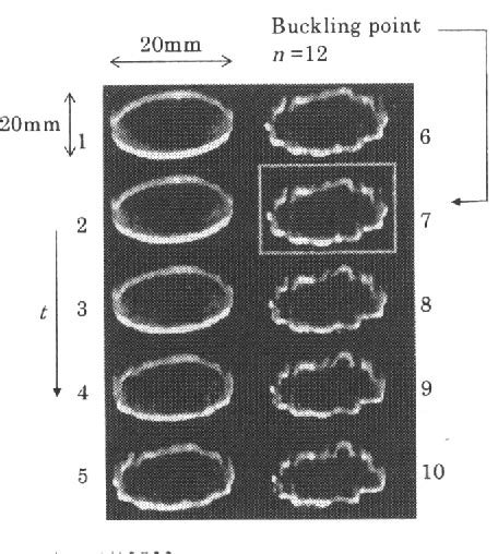 Figure 4 From Analysis Of Airway Narrowing Based On Dynamic Buckling