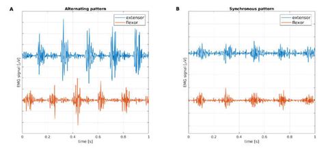 One Second Of Emg Recording From Extensor And Flexor Muscles Of A One Download Scientific