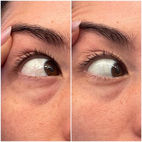 Lumify Eye Drops Review See Photos Popsugar Beauty