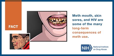 Sores Meth