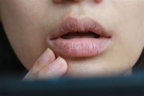 Boca Seca Mau Hálito E Mais Os Efeitos Indesejados Do Uso De Ozempic