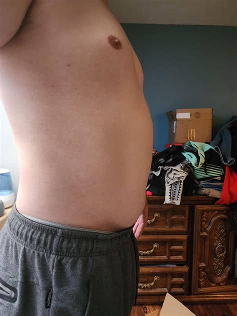 Before And After Water Inflation Rmalebellyinflation