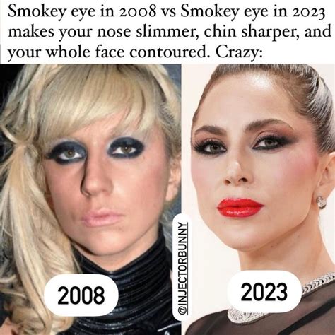 I Couldnt Decide Which Oscars Plastic Surgery Meme So You Get Both