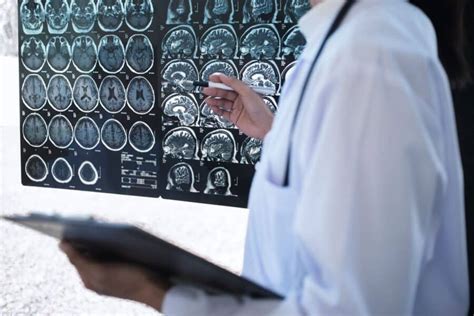 How To Deal With Radiology Scan Report Errors Sims Life