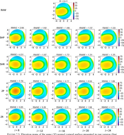 Analysis Of The Human Corneal Shape With Machine Learning Par