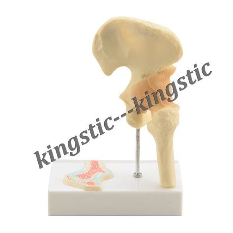 Cbm 103b Hip Joint With Ligament And Saggital Section Kingstic