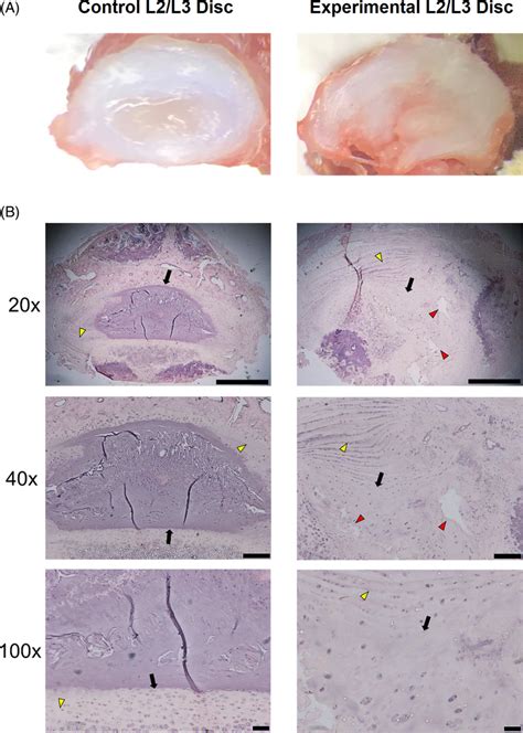 Effects Of Annular Puncture On Rat Disc Gross Morphology And