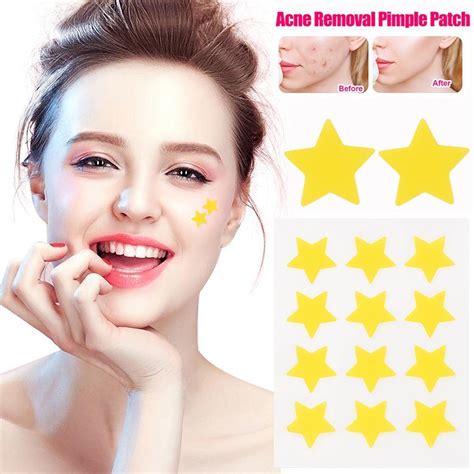 Jual Acne Patch Pimple Patch Heart Star Merah Jambu Hijau Ungu Biru Sticker Jerawat Pimple Patch