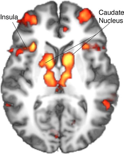 Single Glm Violation Hypothesis I Contrast Main Effect Of Movements Download Scientific
