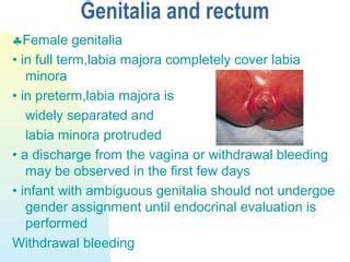 Physical Assessment Of The Neonate Ppt