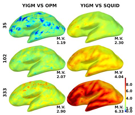Distribution Of The Relative Snr Over The Cortex For Magnetometers