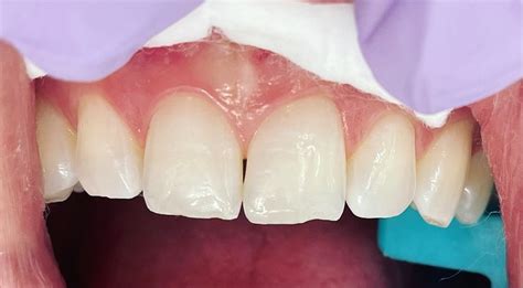 Dr Phoebe Rose Fortenberry Dds Drphoebedds • Instagram Photos And Videos