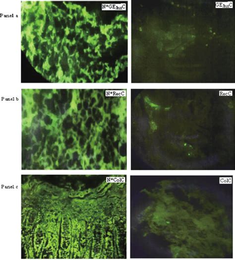 Immunofluorescence Staining Of Tissue Sections Expression Of E3b1