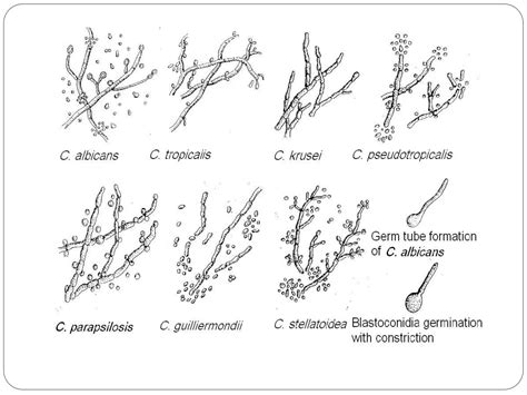 Candida Pptx Skin And Dermatology Diseases And Conditions