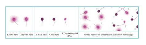 Laboratoř Lékařské Genetiky Karlovy Vary