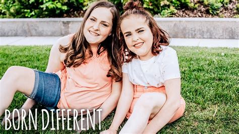 60 Million Views For Bbcs Conjoined Twins Directed By Sohrab Mirmont