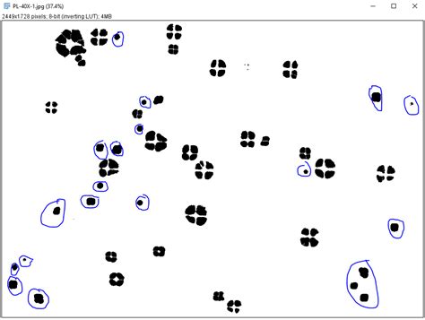 How Can I Remove Specific Particles In Imagej Researchgate