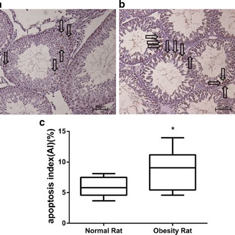Apoptosis Of Spermatogenic Cells In Testicular Tissues And Comparison Download Scientific