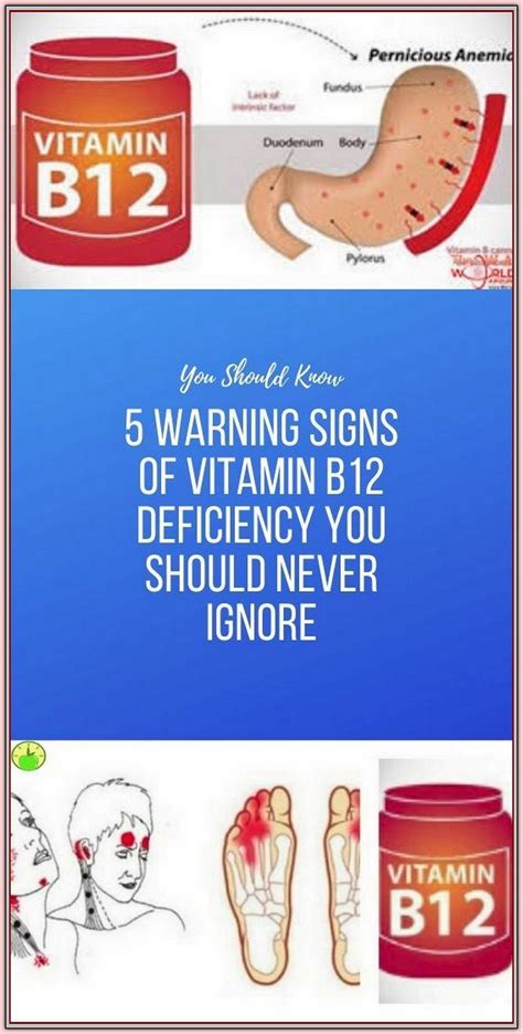 Signs Of Vitamin B12 Deficiency Artofit