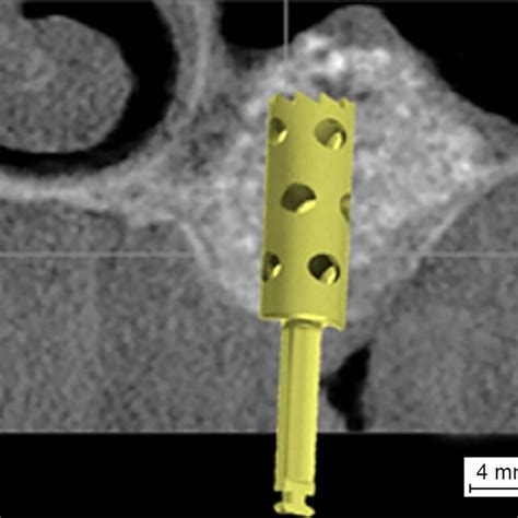 Harvesting Of The Histological Specimens Download Scientific Diagram