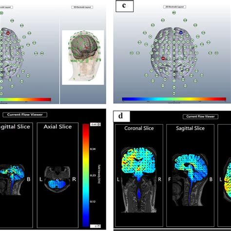 Electrode Configuration And Current Flow In The 2 Groups 2a2b Download Scientific Diagram