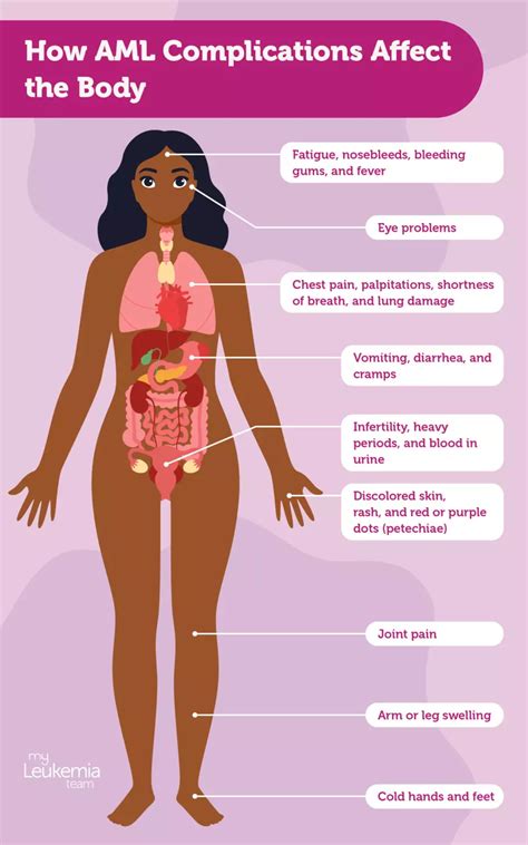 Complications From Acute Myeloid Leukemia 8 Things To Look For