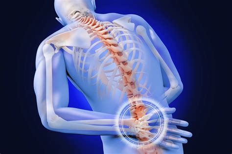 Lower Lumbar Fusion