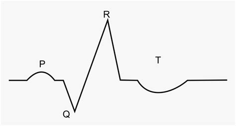 Figure 31 2 The Normal Electrocardiogram Diagram Quizlet