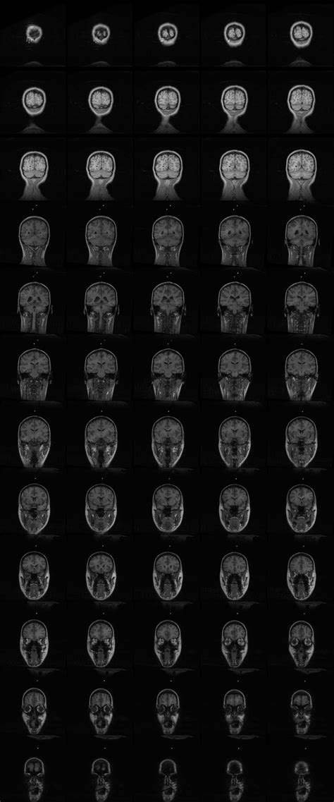 How Can I Merge Watershed Segmentation Regions To Improve Segmentation Researchgate