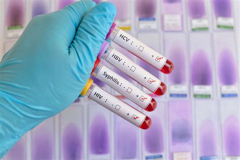 Innovative Sti Program Is Helping To Combat Surge In Syphilis