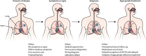 Tuberculosis Signs And Symptoms