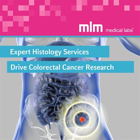 Sujata Prasad Posted On Linkedin