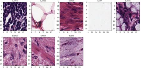 Figure 4 From Colorectal Multi Class Image Classification Using Deep Learning Models Semantic