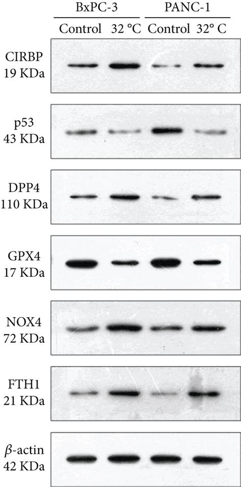 Cold Induces Cirbp Expression To Affect The Expression Of Key