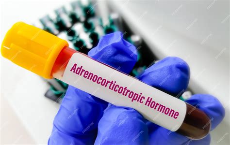 Premium Photo Adrenocorticotropic Hormone Acth Test Acth Regulates Cortisol And Androgen