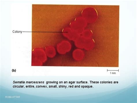 Colony Morphology Describing Bacterial Colonies Roba Attar Dr