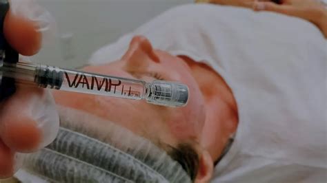 Vamp Facial Salmon Dna Microneedling Treatment Discover Youthful Skin
