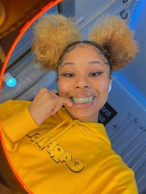 Pin By Dolliess On Gals Cute Girls With Braces Braces Colors
