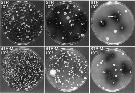 Isolation Of Streptomyces Spp On A Semi Selective Culture Str And