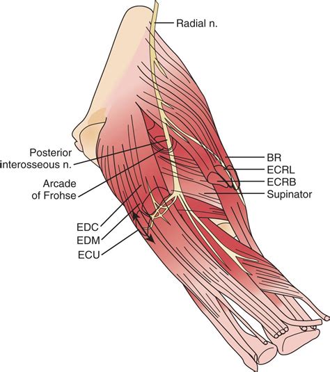 Nerve Entrapment Syndromes Clinical Tree