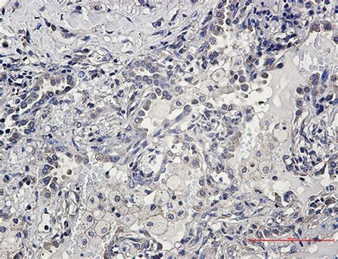 Rabbit Anti Akt Monoclonal Antibody8a4 爱必信absin官网