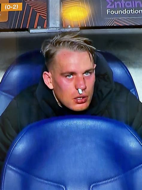 ریک کارسدورپ، دربی دلاکاپیتاله را از دست داد طرفداری