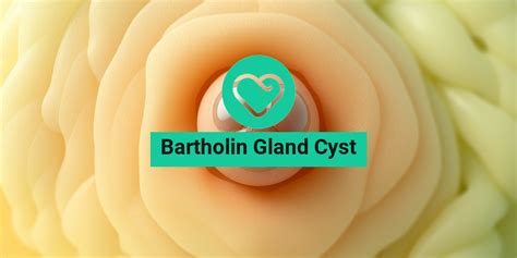 Bartholin Gland Cyst Understanding Symptoms Causes And Treatments