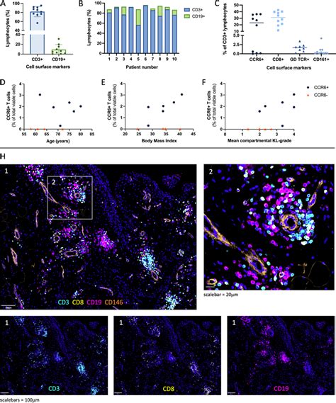 Lymphocytes In Advanced Oa Synovium Ab Relative Frequency Of T Download Scientific Lymphocytes In Advanced Oa Synovium Ab Relative Frequency Of T Download Scientific